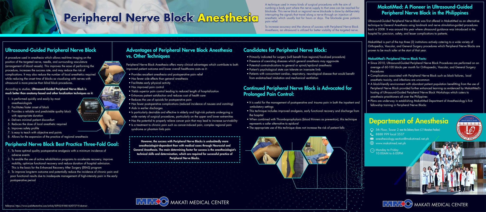 Peripheral Nerve Block Anesthesia (2018) | MakatiMed Exhibit
