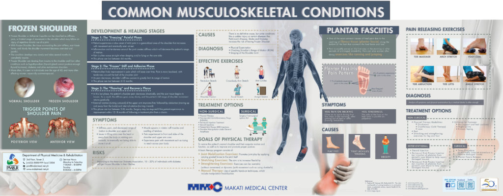 Common Musculoskeletal Conditions Explained | MMC Exhibits