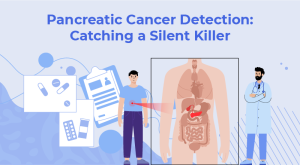 Pancreatic Cancer in Philippines: Catching the Silent Killer