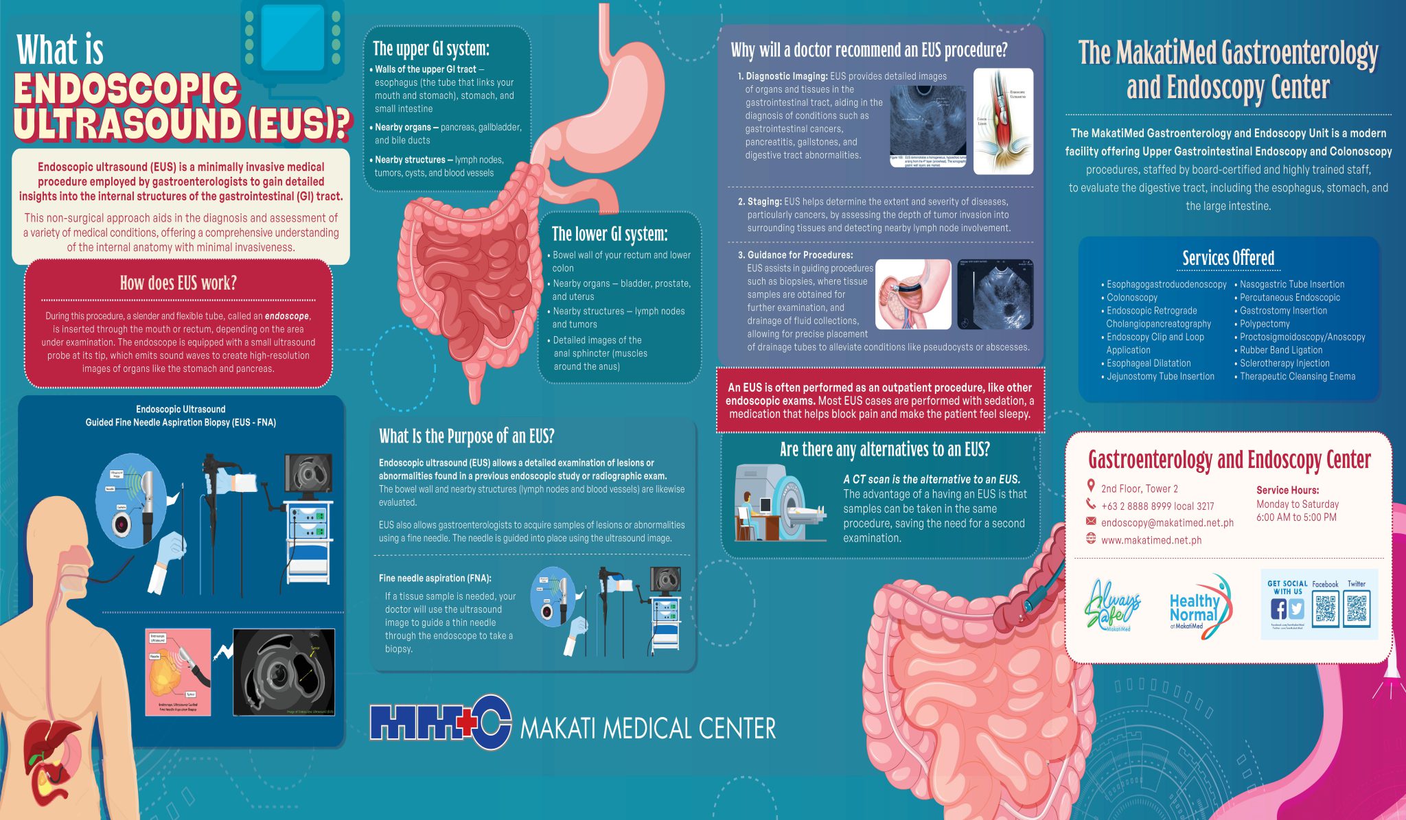 Endoscopic Ultrasound (EUS) Overview | MakatiMed Exhibits