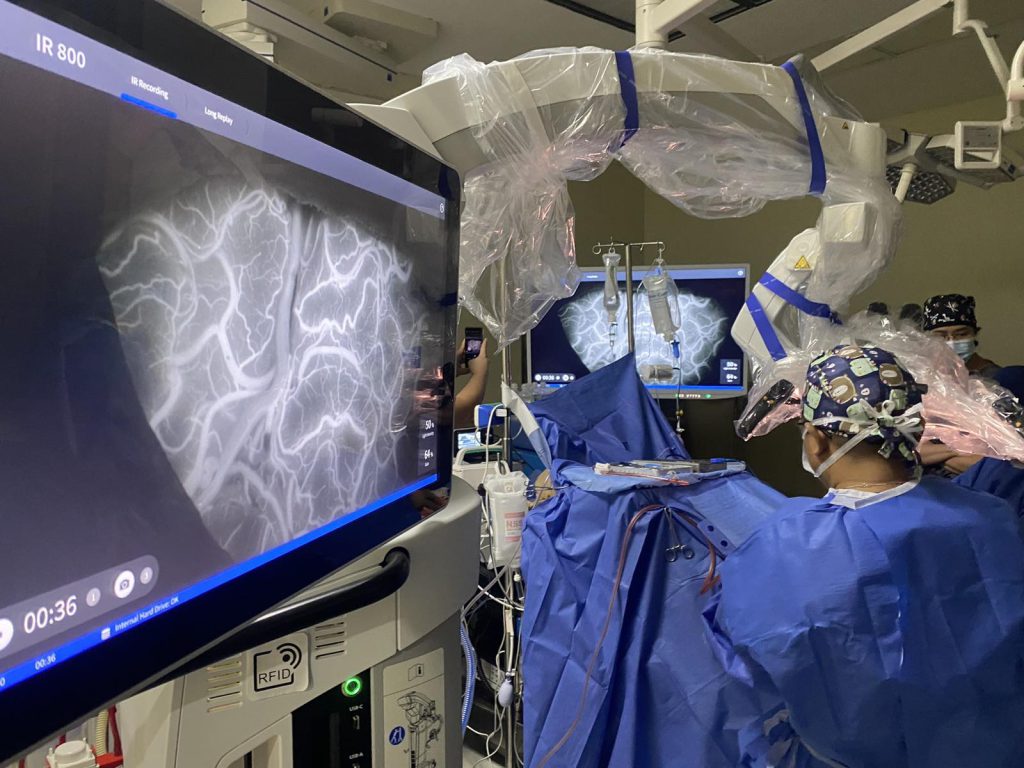 Life-Saving Surgery for Giant Brain Aneurysm at MakatiMed